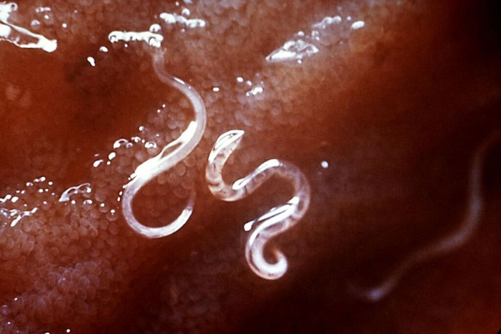 Parasites in Ancient Jerusalem: A New Study (Rather Gruesomely ...