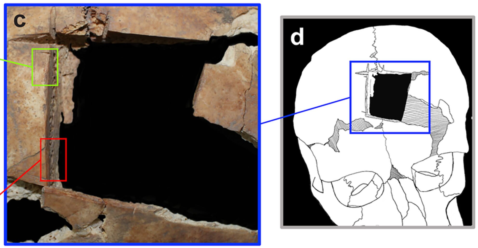 Evidence of Late Bronze Age Brain Surgery Found in Megiddo ...